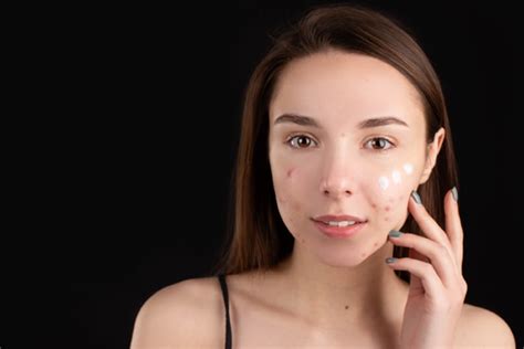 A Beginners Guide To Retinol Essentialslk