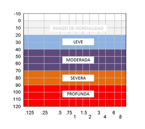 Tipos De Hipoacusia Share Rare The Best Porn Website
