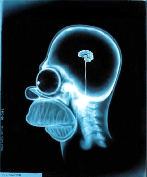 Homer Simpsons X Ray Funny Pictures At English Zone Com