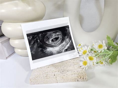 임신 극초기증상 시기 착상혈 색 양 네이버 블로그