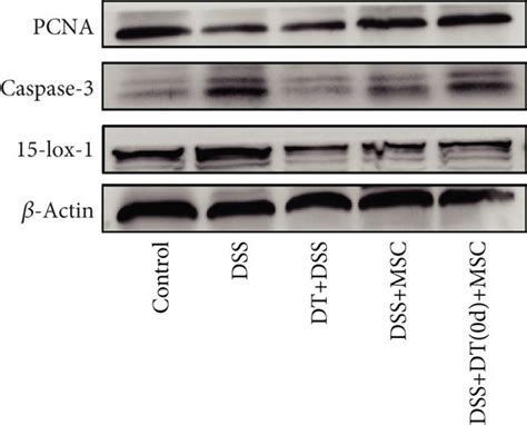 Hucmscs Attenuate The Dss Induced Ibd Through Regulating Macrophages