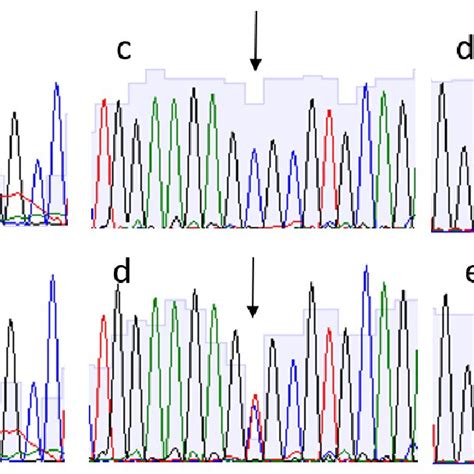 Electropherograms Of The Variants Tested Panel A C D Showing The Download Scientific Diagram