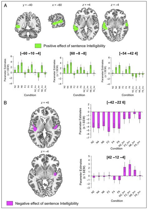 A Positive And B Negative Effects Of Sentence Intelligibility Download Scientific Diagram