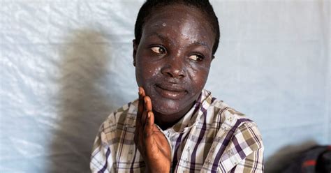 On The Frontlines Of Congos Deadly Mpox Outbreak August 20 2024