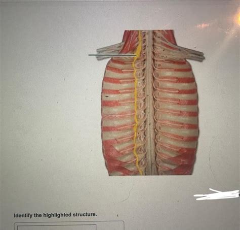 Solved Identify The Highlighted Structure