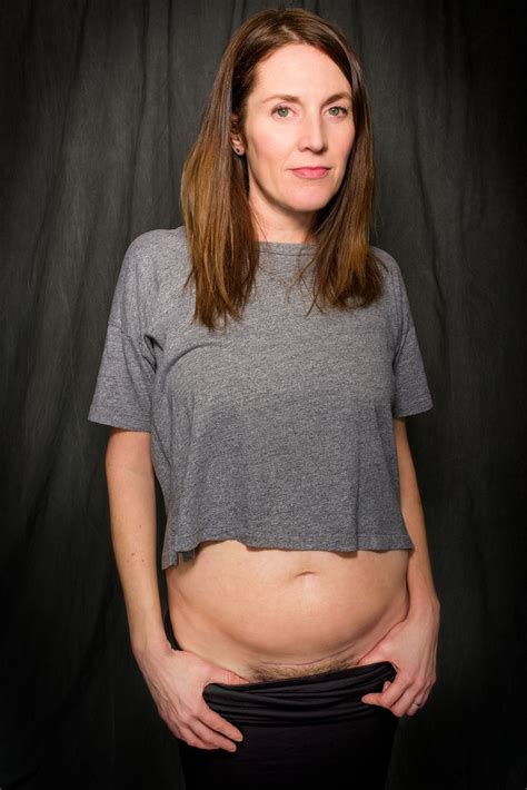 10 Incredible C Section Storiesand The Scars That Go With Them SELF