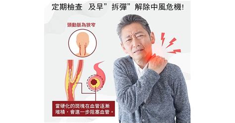 每4人就有1人頸動脈超音波異常恐腦中風醫籲15分鐘檢查遠離腦中風 華人健康網 專業即時優質的健康新聞及資訊分享平台業即時優質的