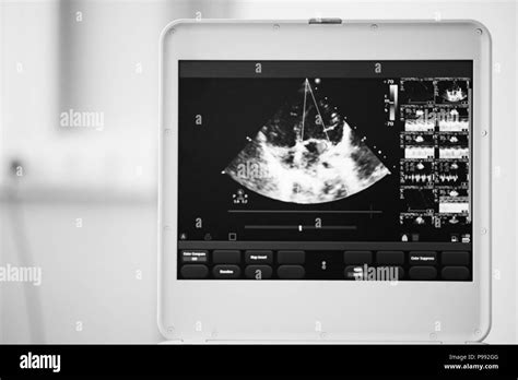 Echocardiogram Procedure Hi Res Stock Photography And Images Alamy
