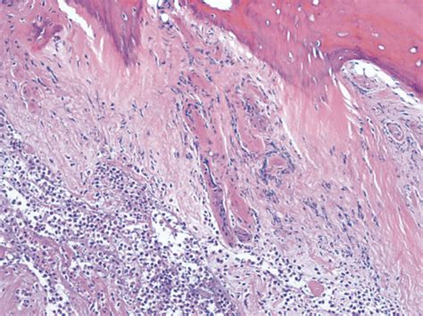 Pathology Bone Diseases Images Flashcards Quizlet