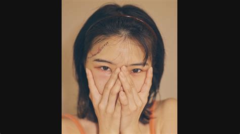 アイナ・ジ・エンドさん 6日に活動再開 顔を約30針縫うケガから復帰へ「安定した状態まで回復してまいりました」 Tbs News Dig