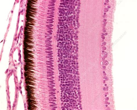 Layers Of The Retina Light Micrograph Stock Image C0477805