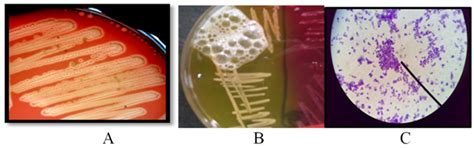 Staphylococcus Aureus Catalase Test