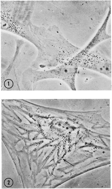 Cells In Primary Culture Derived From A Human Basal Cell Carcinoma