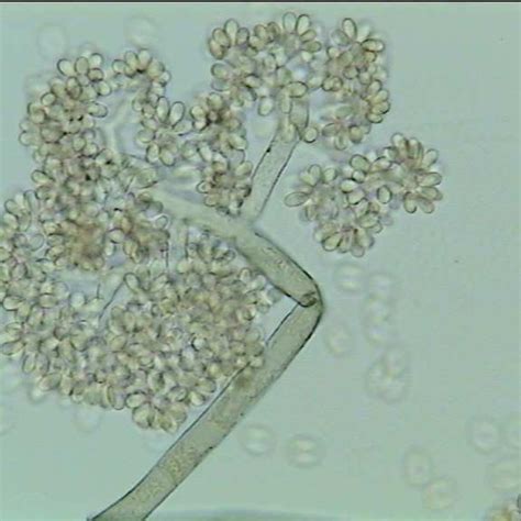 Pdf In Vitro Studies Regarding The Morphology Of Botrytis Cinerea