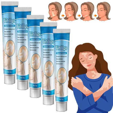 Buy Kolmax Vitiligo Soothing Ointment MEDix S Vitiligo Cream Kolmax