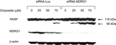 Figure 1 From Role Of Gli1 And Ndrg1 In Increased Resistance To