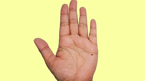 Lucky Mole On Body Meaning These Parts Of Moles In Body Consider Lucky
