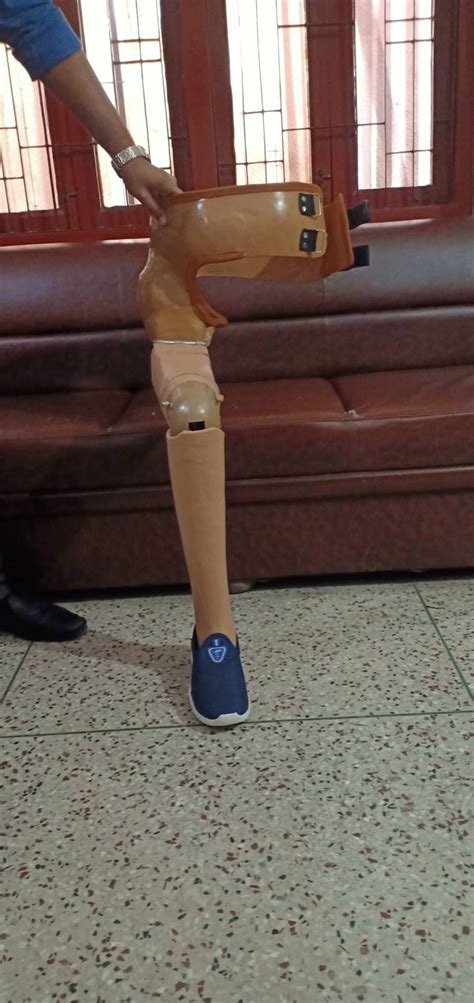 Hip Disarticulation Prosthesis Hd Easy Life For Bangladesh