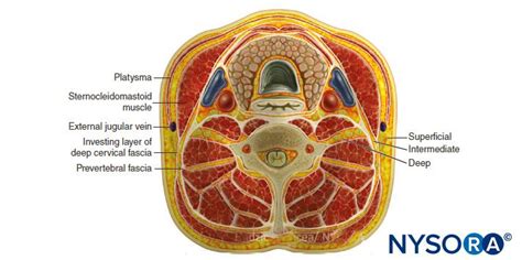 Ultrasound Guided Cervical Plexus Block NYSORA