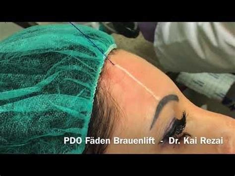 PDO Fadenlifting Brauenlifting Fäden Dr Kai Rezai YouTube