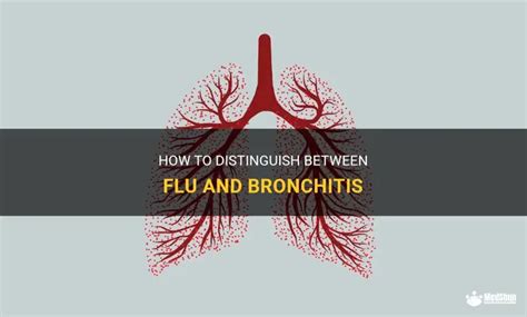 How To Distinguish Between Flu And Bronchitis Medshun