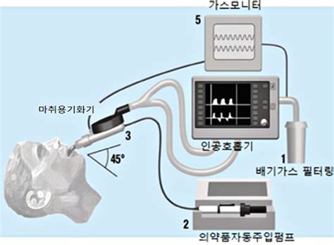 Hi Neca Vol40 9월호 신의료기술평가 소식 알기 쉬운 신의료기술평가 보고서 흡입마취제 진정요법