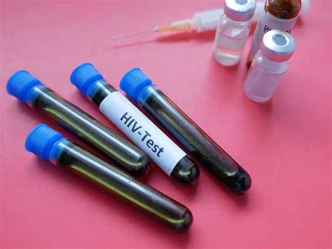 1 декември Световен ден за борба с ХИВ СПИН Gpnews