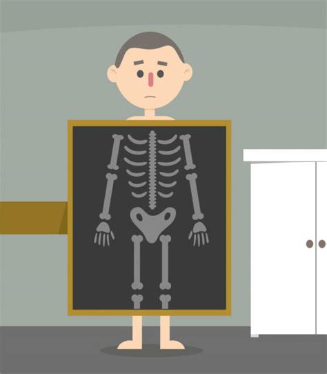 Drawing Of Chest X Ray Illustrations Royalty Free Vector Graphics