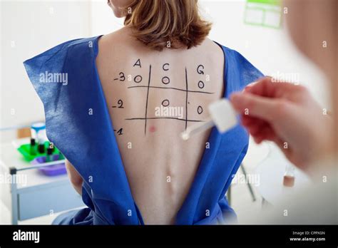 Allergy Testing Hi Res Stock Photography And Images Alamy