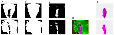 Deep Learning Based Airway Segmentation Using Key Point Prediction