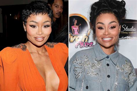 Blac Chyna Steps Out For First Time After Dissolving Facial Fillers