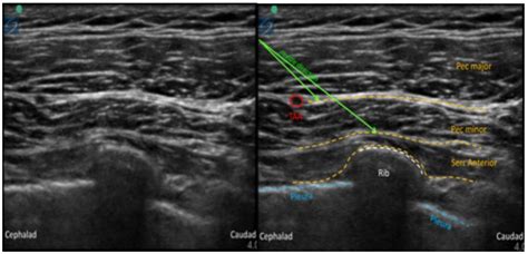 Pecs Blocks Virtual Library