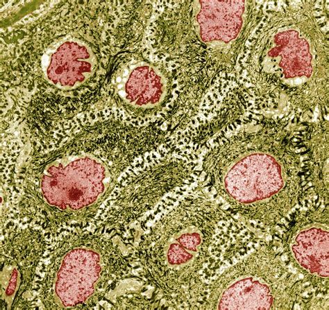 Skin Cells Skin Cells Skin Cell