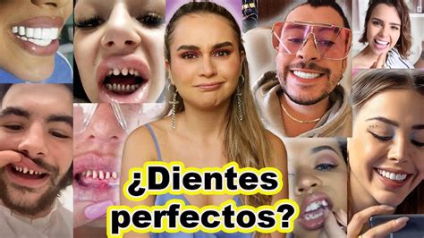 La Peligrosa Obsesión De Los Influencers Por Tener Dientes Perfectos