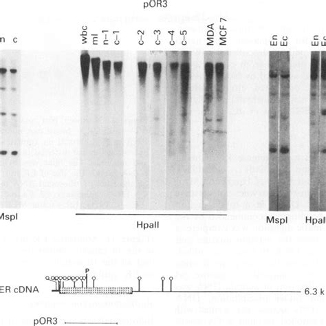 Southern Blot Hybridisation Of Dna From Human Normal N And Neoplastic
