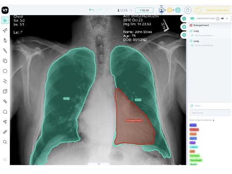 Machine Learning Object Detection And Computer Vision Application