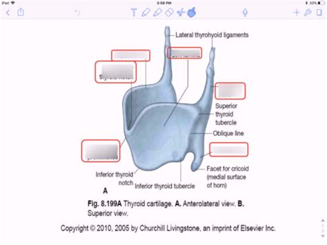 Thyroid Notch