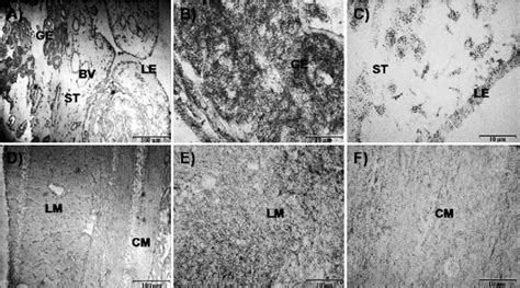 Demonstration Of 15 Hydroxyprostaglandin Dehydrogenase 15 Pgdh