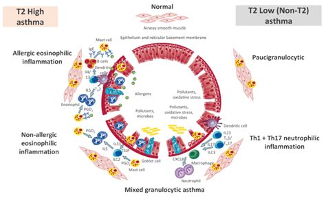 Airway Inflammation Asthma In Pregnancy Toolkit