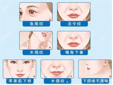 大连玥美医疗美容价格表眼综合肋骨鼻拉皮除皱价格很详细除皱对比照 8682整形网