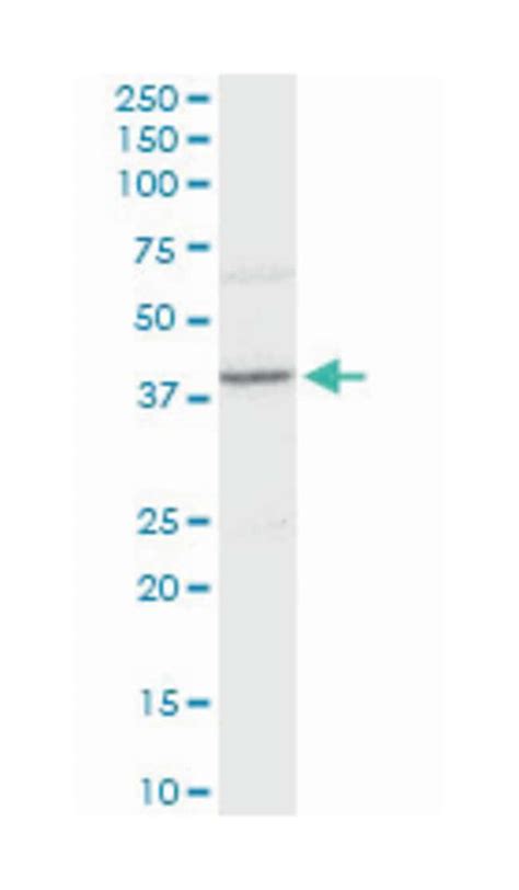 opioid receptor kappa 1 Mouse Polyclonal Antibody Abnova 50μL Unlabeled Antibodies