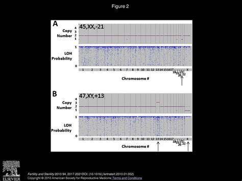 Accurate Single Cell 24 Chromosome Aneuploidy Screening Using Whole