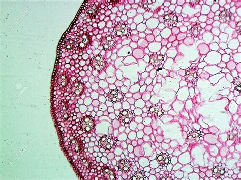 Parenchyma Definition Function Types And Involvement In The