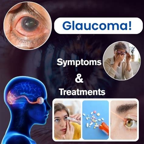Glaucoma Signs Types And Treatments Nandadeep Eye Hospital
