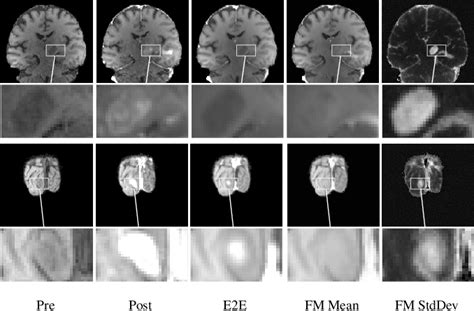 figure 2 from conditional generative models for contrast enhanced