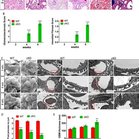 Podocyte Structure A Scanning Electron Microscope Image Of A