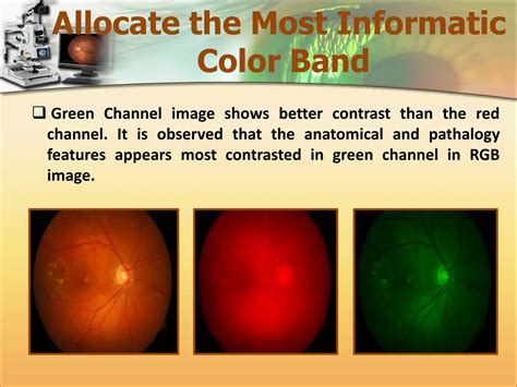 Automatic Detection Of Diabetic Maculopathy From Fundus Images Using