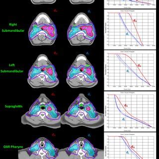 Schematic Representation Of Temporally Feathered Radiation Therapy The