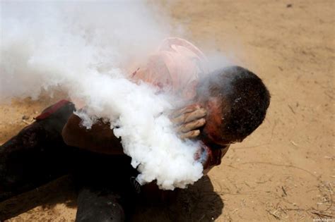 Una Granada De Gas Lacrimógeno Deja A Un Joven Palestino Al Borde De La