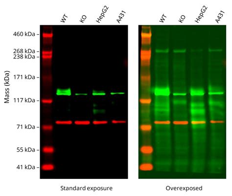 Human Ldlr Ldl Receptor Knockout Hela Cell Line Ab273838 Abcam